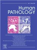 Human Pathology《人体病理学》_论文投稿-期刊选题-投稿选刊-万维学术！
